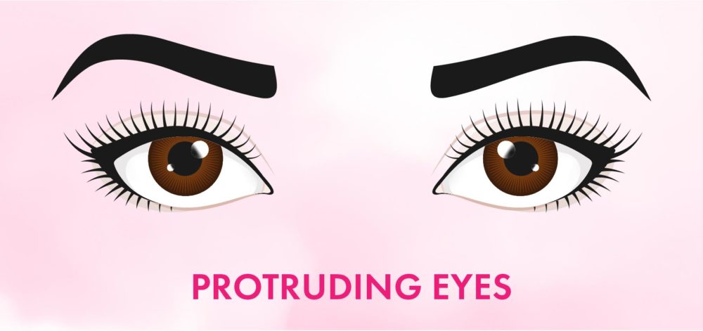 Protruding Eyes – The Self Care Beauty Bar